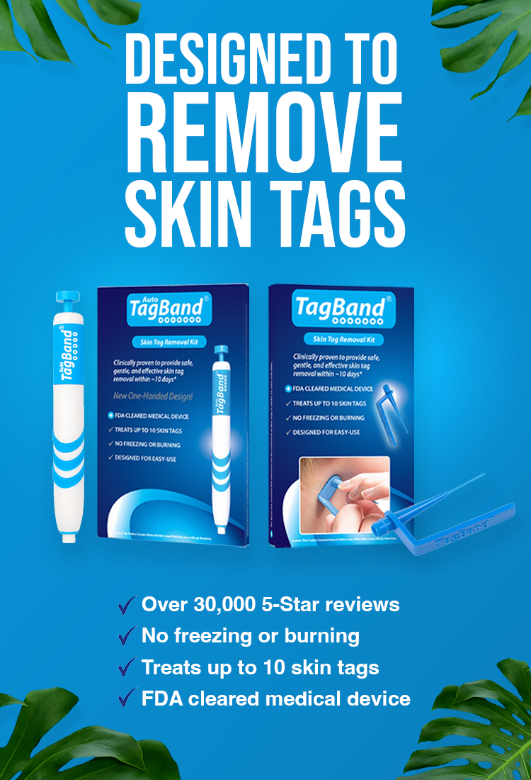 TagBand Skin Tag Removal Device | Tagband Official – TagBand.com