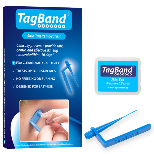 TagBand Skin Tag Removal Device | Tagband Official – TagBand.com